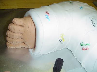 Smandacakes: Broken Leg Cake (Close up of foot)